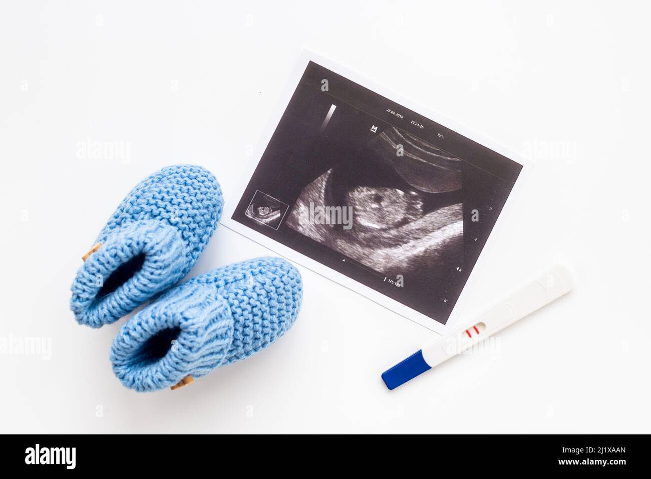 Pregnancy background. Baby accessories with ultrasound picture of ...