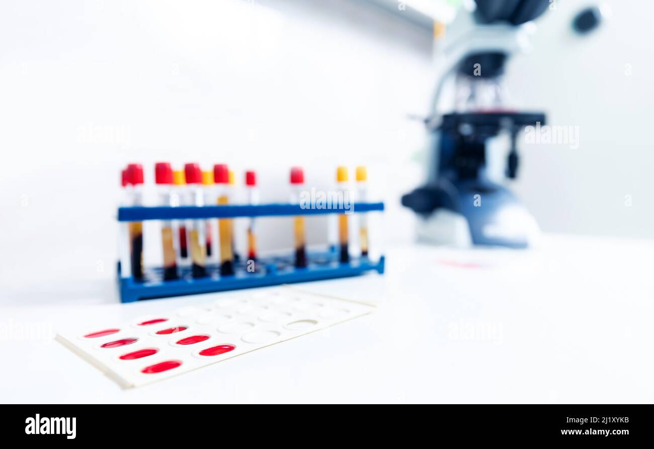Macro photo analyzing blood in tube background microscope at laboratory ...