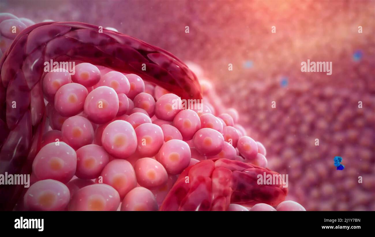 Growing Lump High Resolution Stock Photography and Images - Alamy
