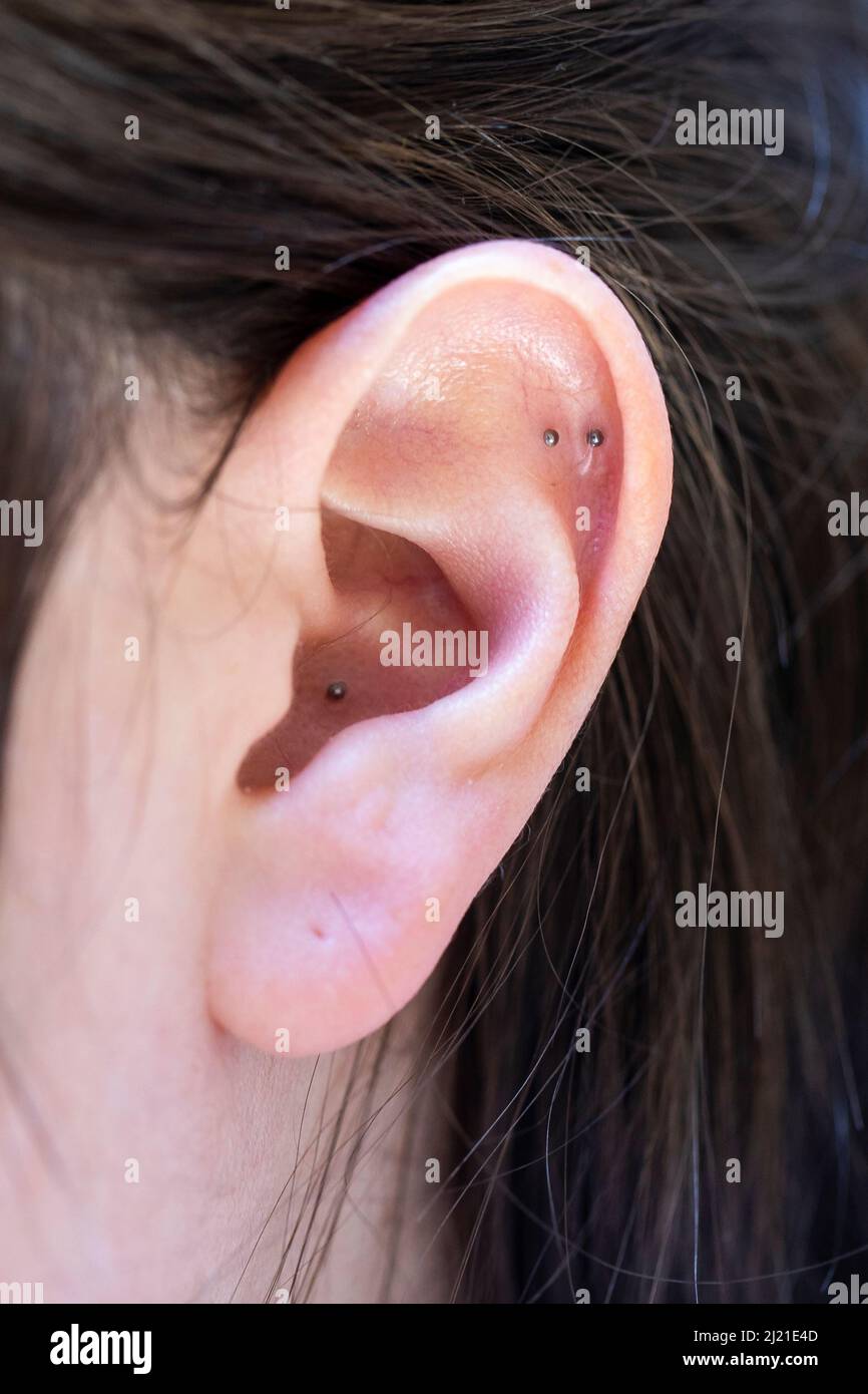 A close up portrait of three ear seeds sticked inside of the ear of a ...