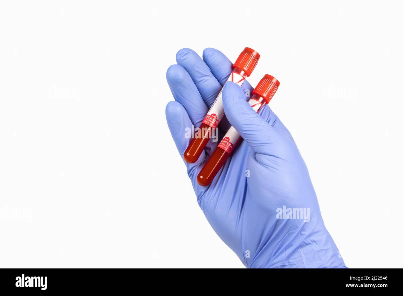 Hand holding test tube with blood plasma ready for testing Stock Photo ...