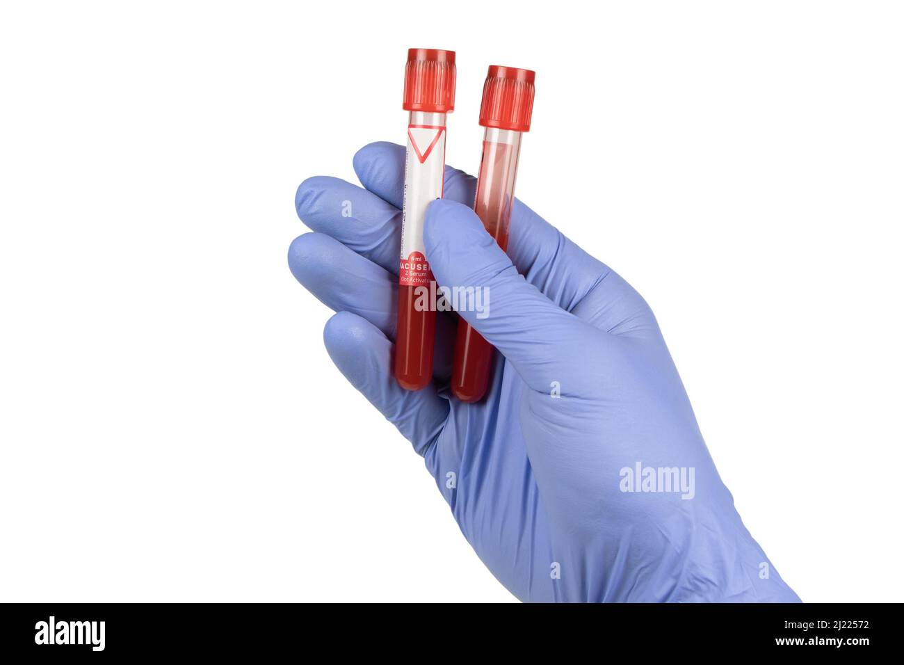 Hand holding test tube with blood plasma ready for testing Stock Photo ...
