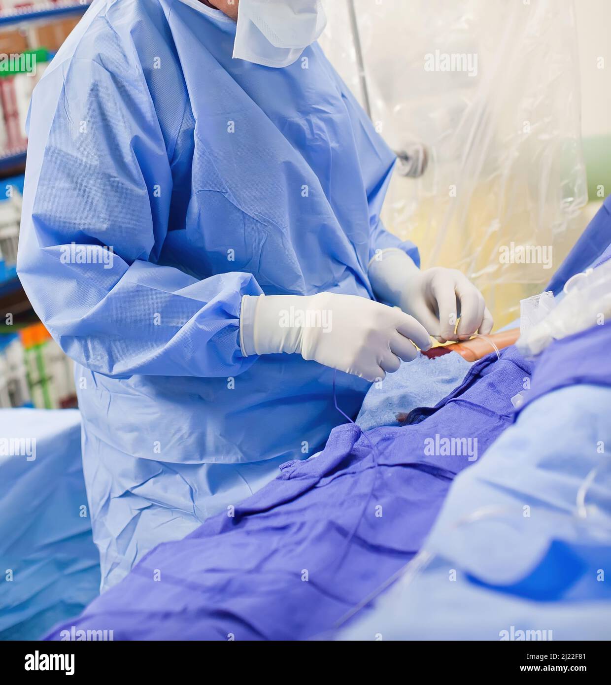 one non-descript surgeon doctor doing a surgery in a surgical room ...