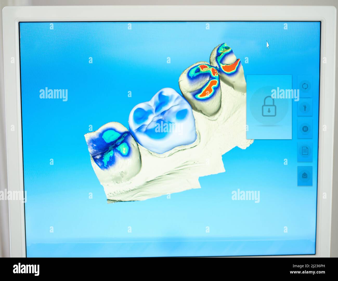 Displaying teeth hi-res stock photography and images - Alamy