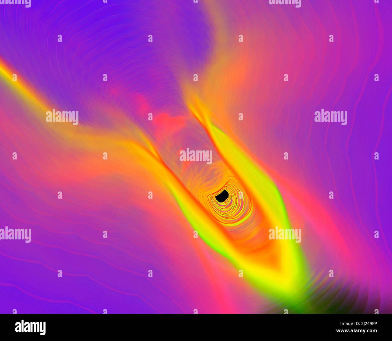 Vocal cords, CT scan Stock Photo - Alamy