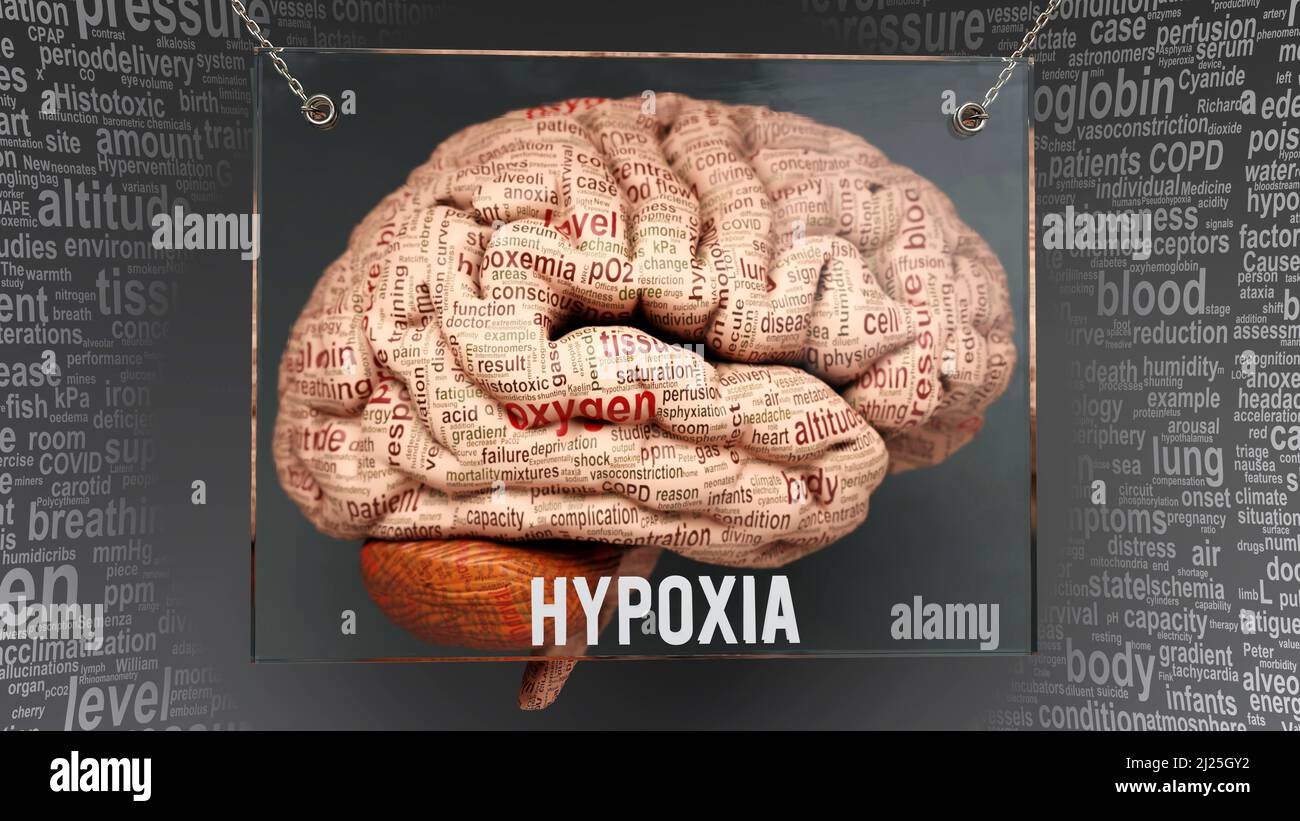 Hypoxia anatomy - its causes and effects projected on a human brain ...