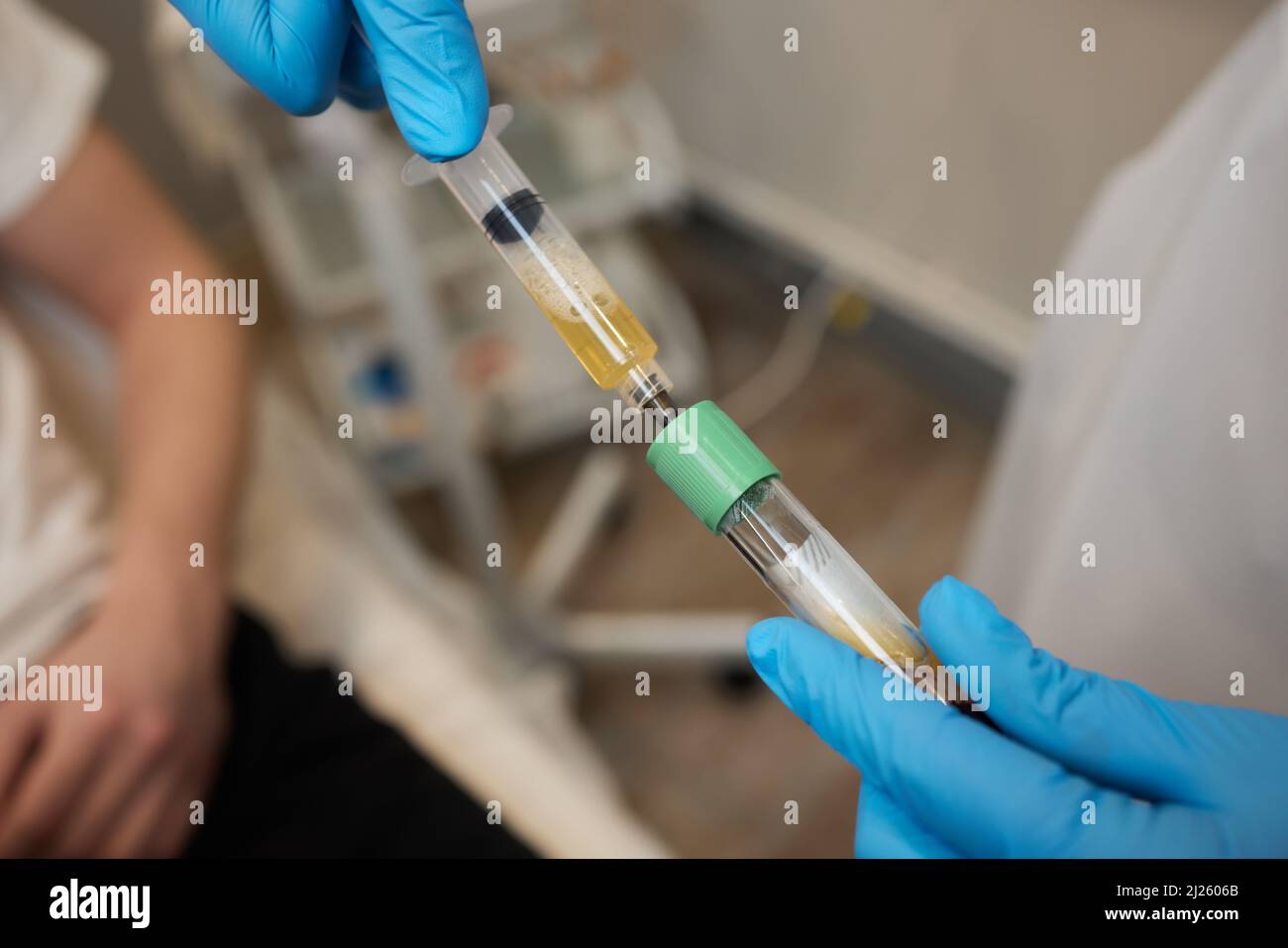 Beautician doctor's hands put test tube with blood in centrifuge ...