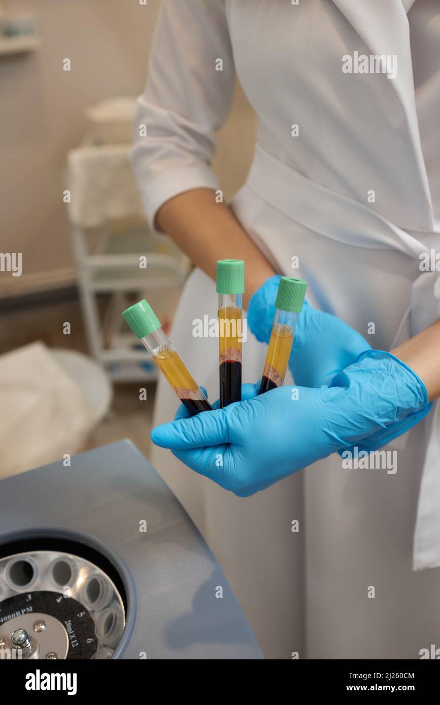 Beautician doctor's hands put test tube with blood in centrifuge ...