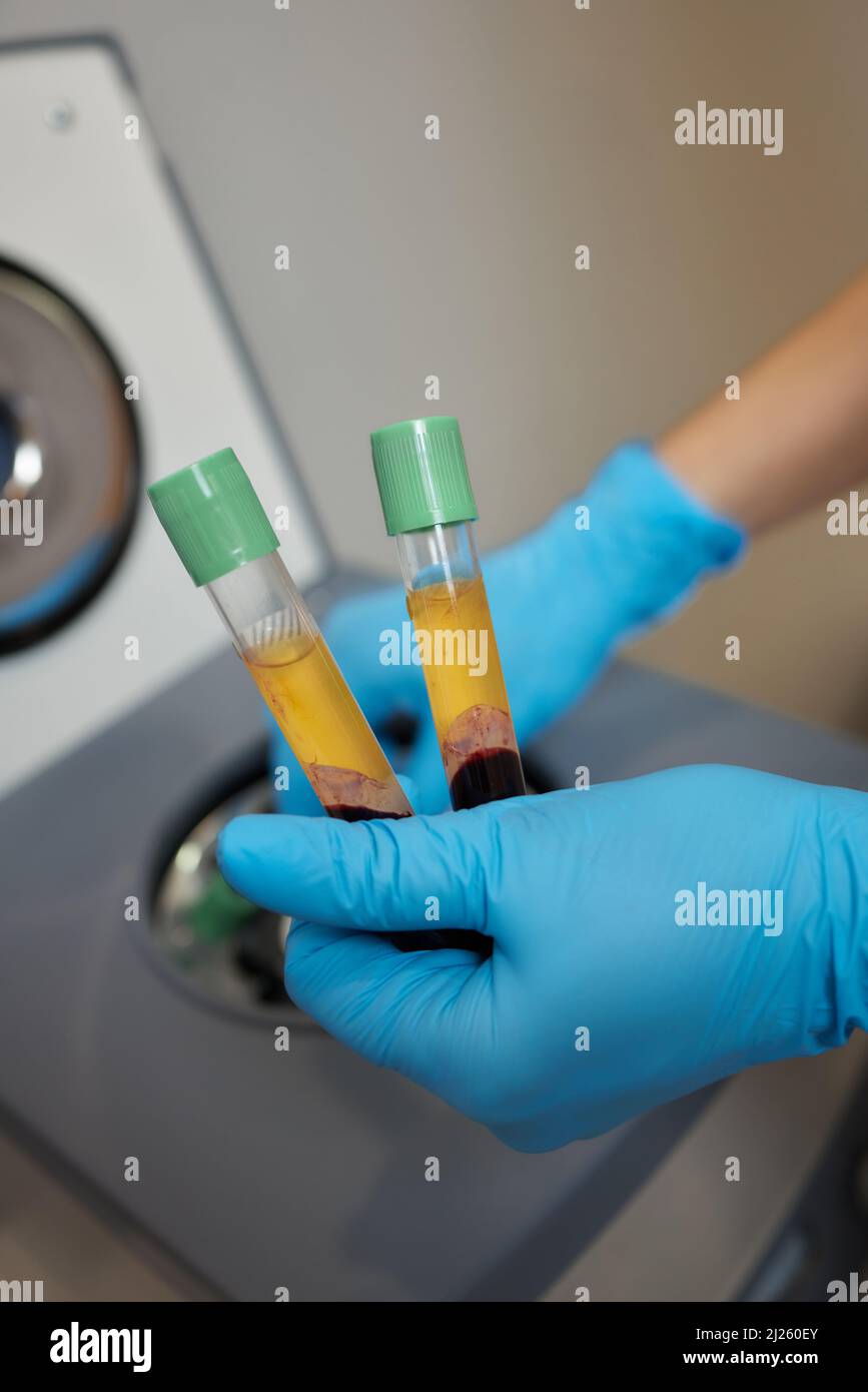 Beautician doctor's hands put test tube with blood in centrifuge ...