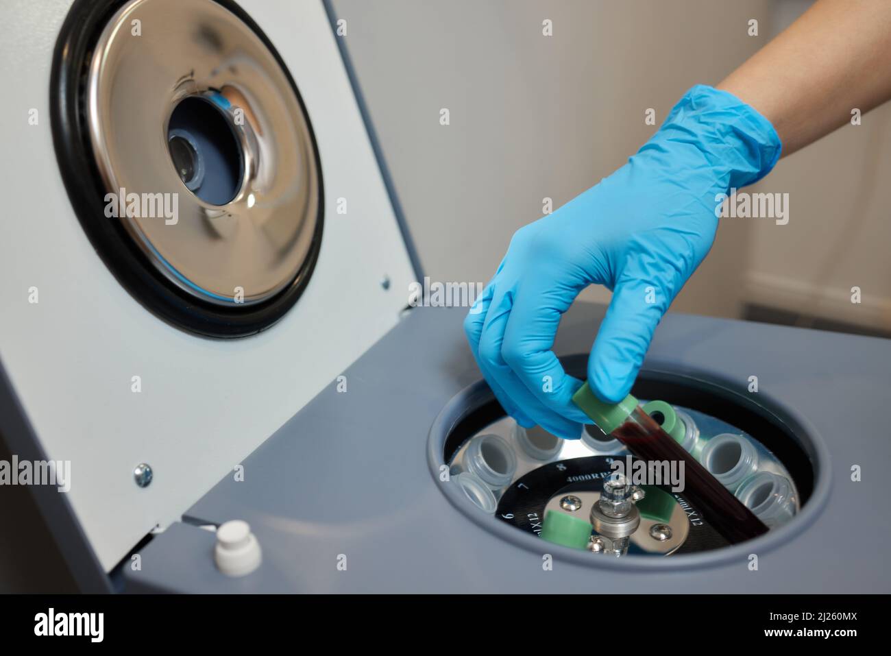 Beautician doctor's hands put test tube with blood in centrifuge ...