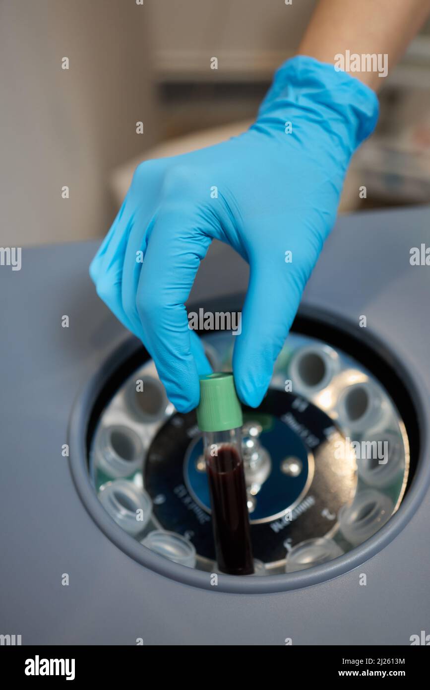 Beautician doctor's hands put test tube with blood in centrifuge ...