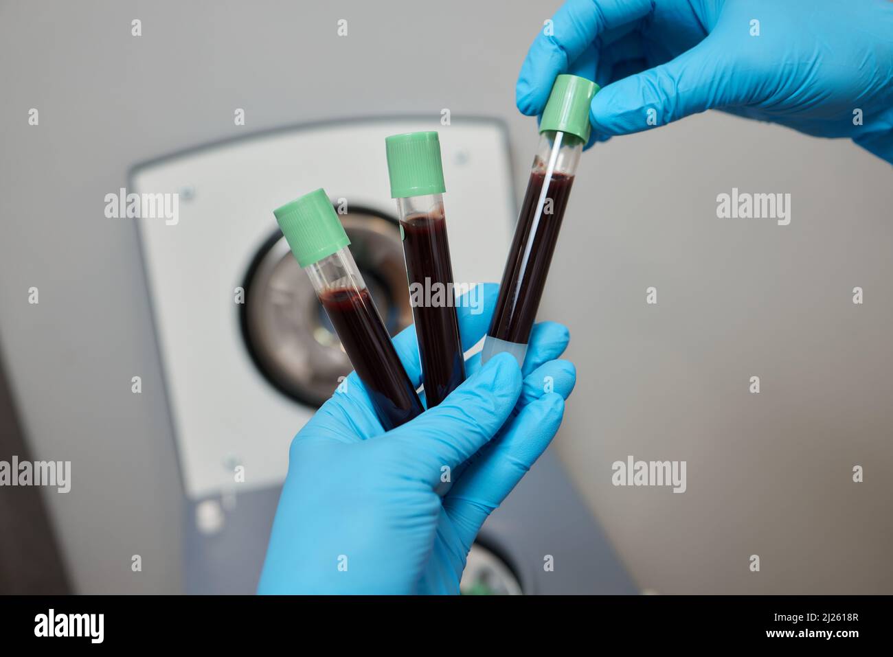 Beautician doctor's hands put test tube with blood in centrifuge ...