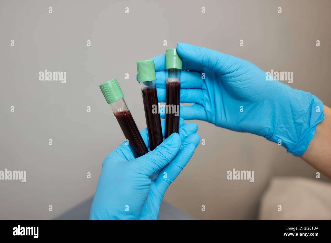 Beautician doctor's hands put test tube with blood in centrifuge ...