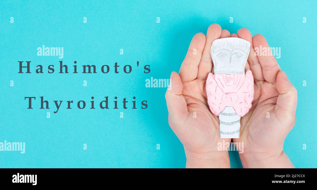 Hashimoto's thyroiditis, chronic lymphocytic disease, holding a thyroid ...