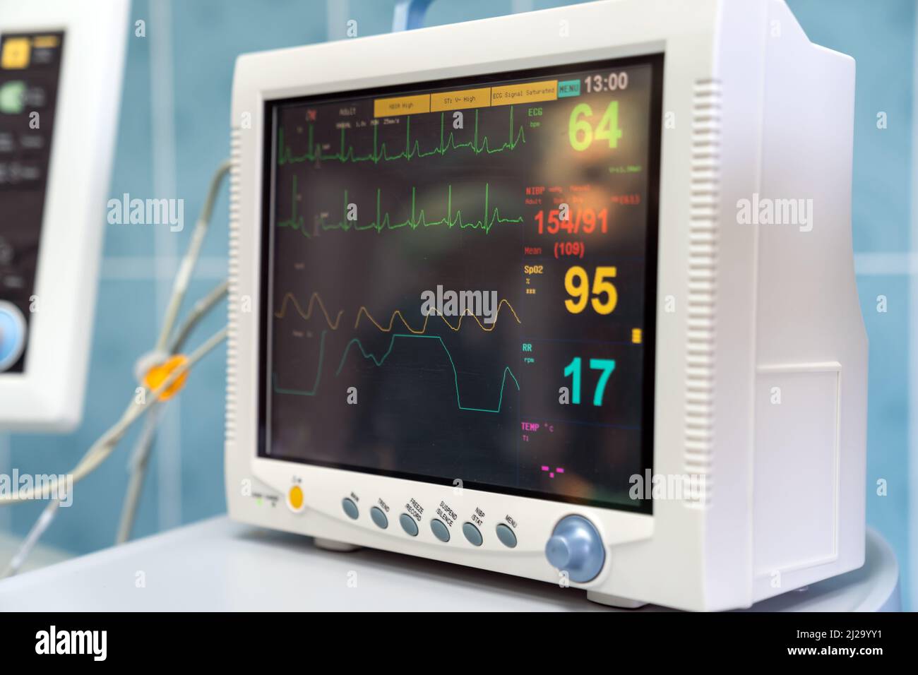 Ecg machine hospital hi-res stock photography and images - Alamy