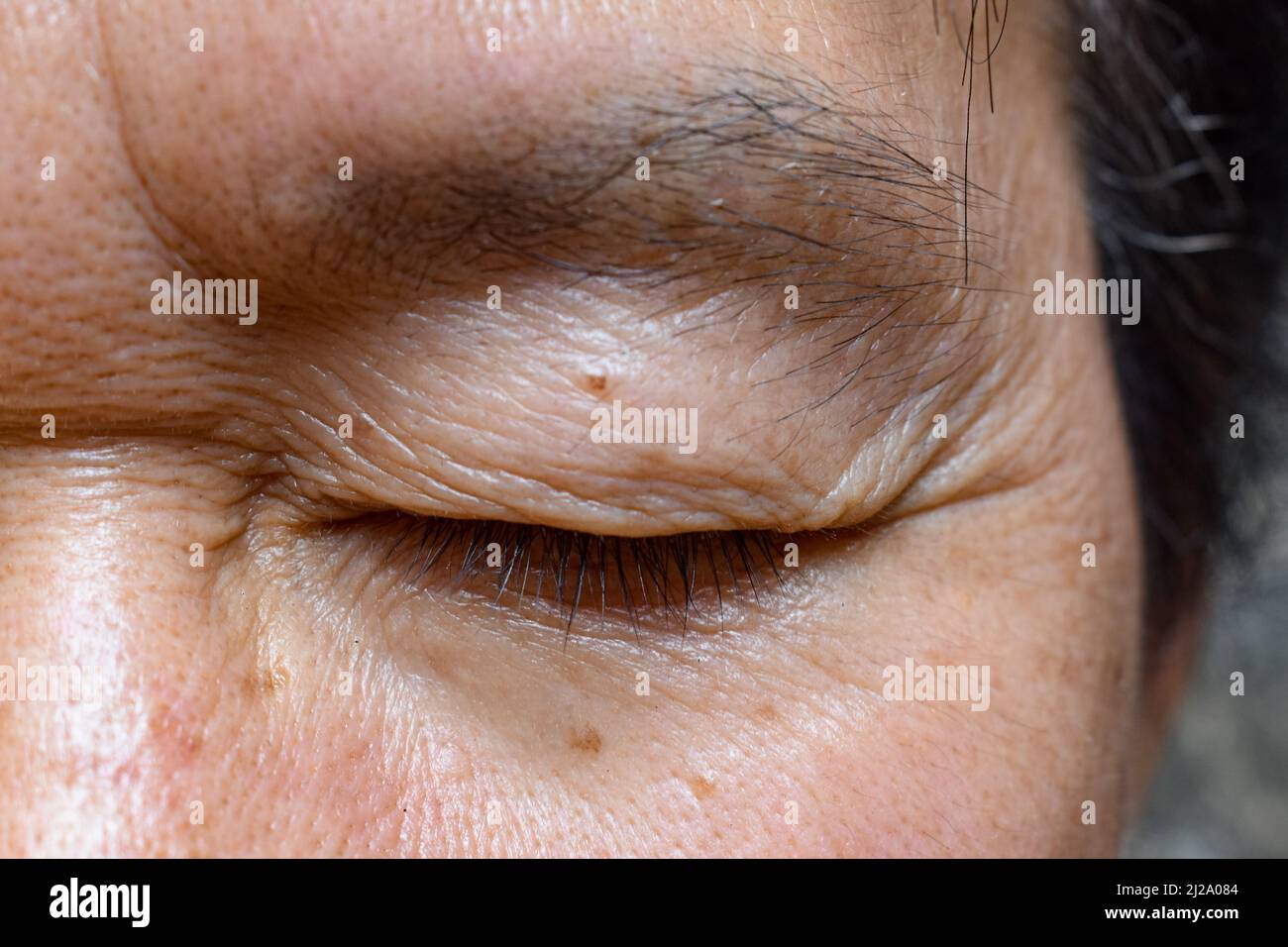 Muscle tear man hi-res stock photography and images - Alamy