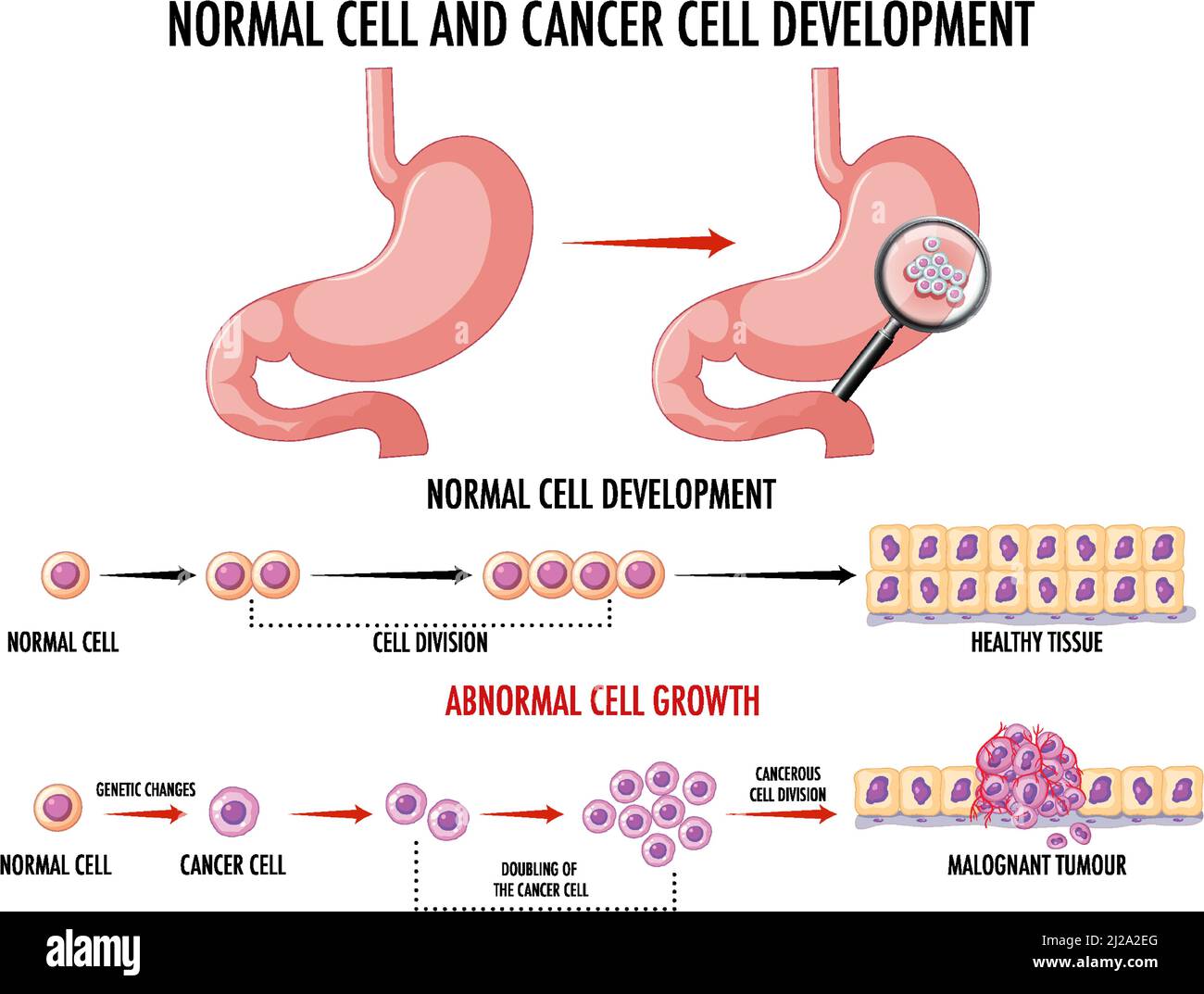 Diagram showing normal and cancer cell illustration Stock Vector Image ...