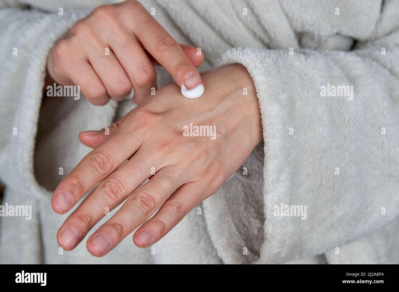 Woman hands with hand cream. Cream application Stock Photo - Alamy
