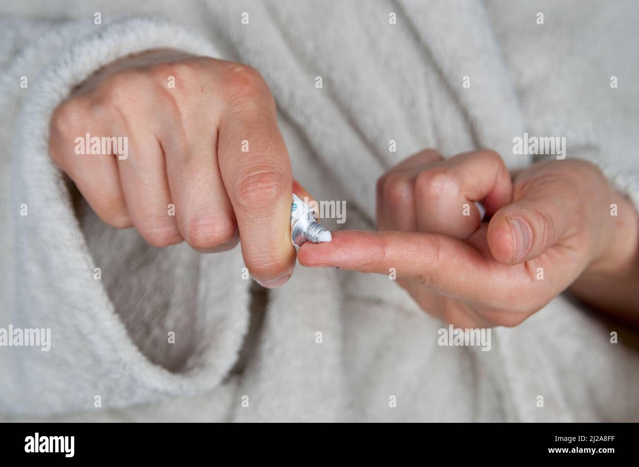 Woman hands with hand ointment. Get ointment from container Stock Photo ...