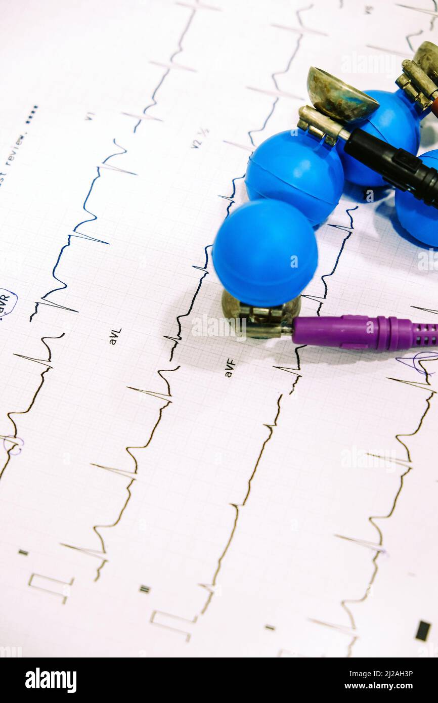 Close up Image of Electrocardiography background Stock Photo - Alamy