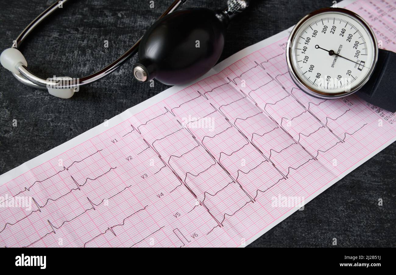 Electrocardiogram printout hi-res stock photography and images - Alamy