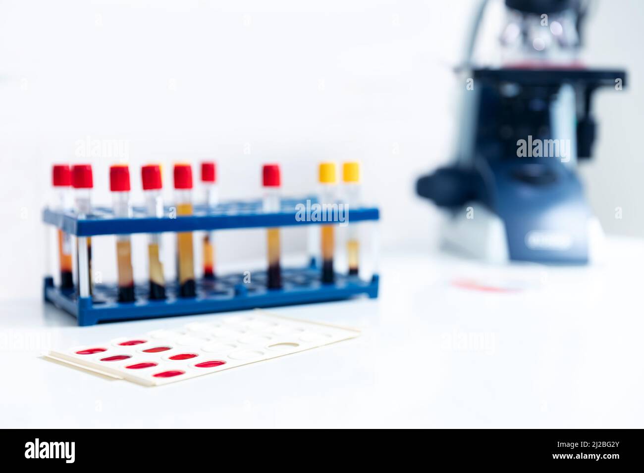 Macro tube with analyzing blood, microscope at laboratory , banner ...