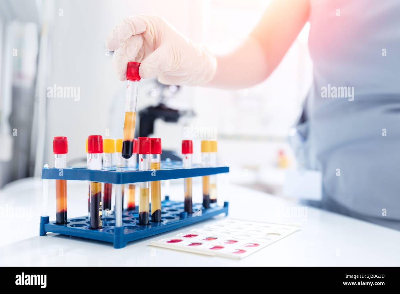 Closeup man worker use microscope in laboratory, analyzing blood test ...