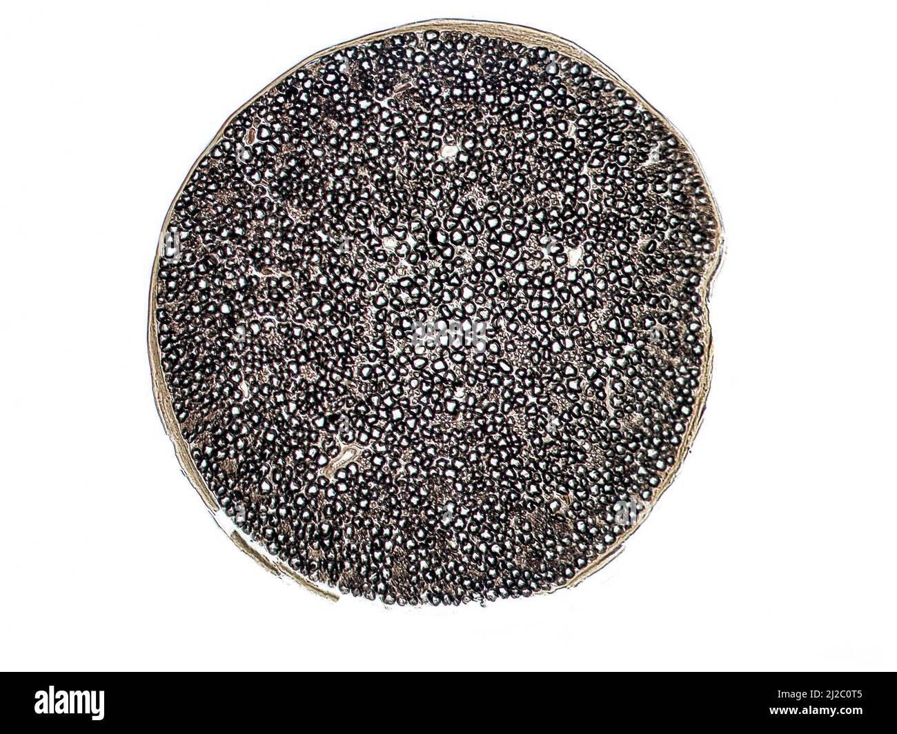 Nerve Fascicle Histology