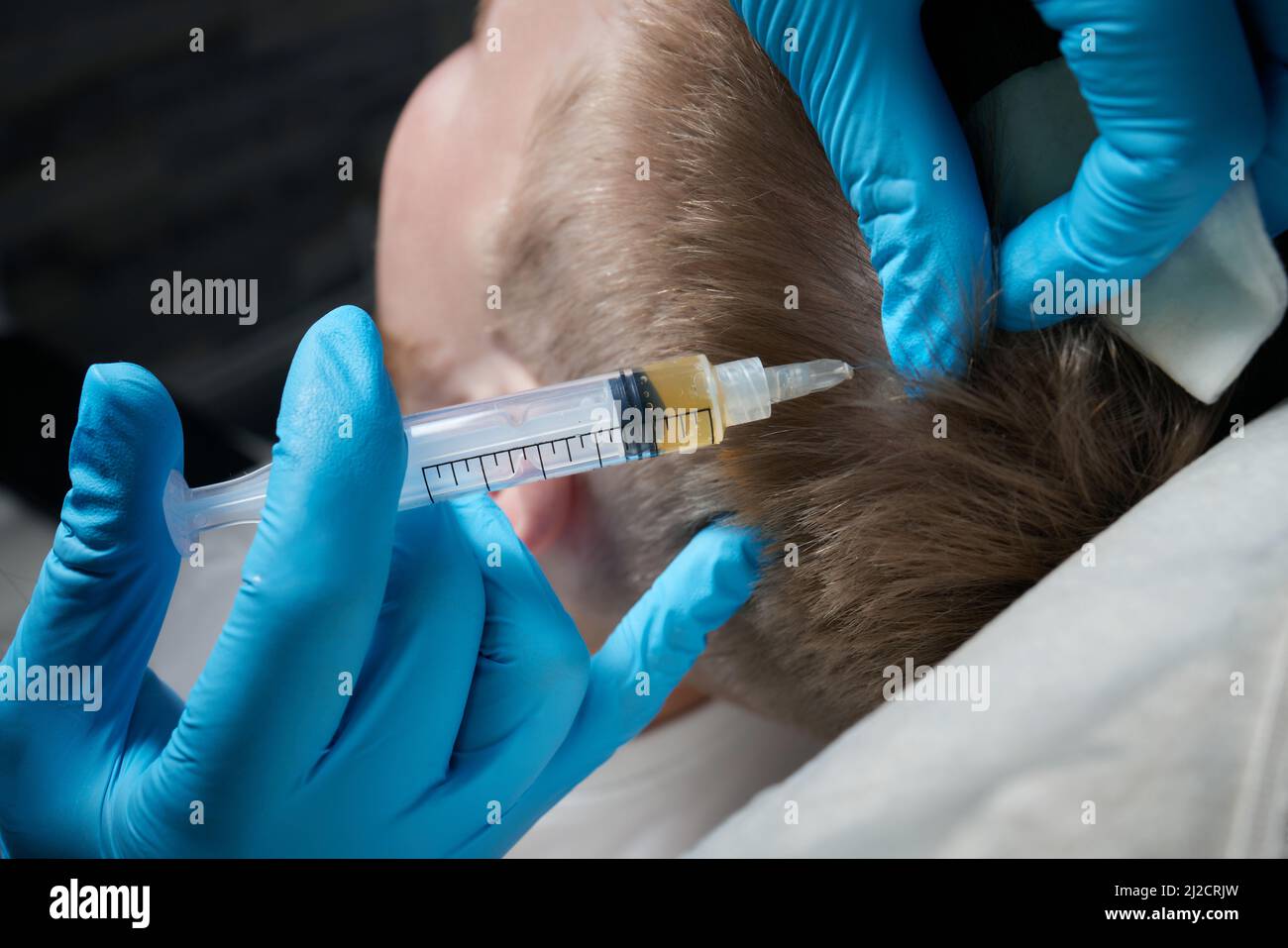 Injection plasma into head hair man cosmetologist doctor Stock Photo ...