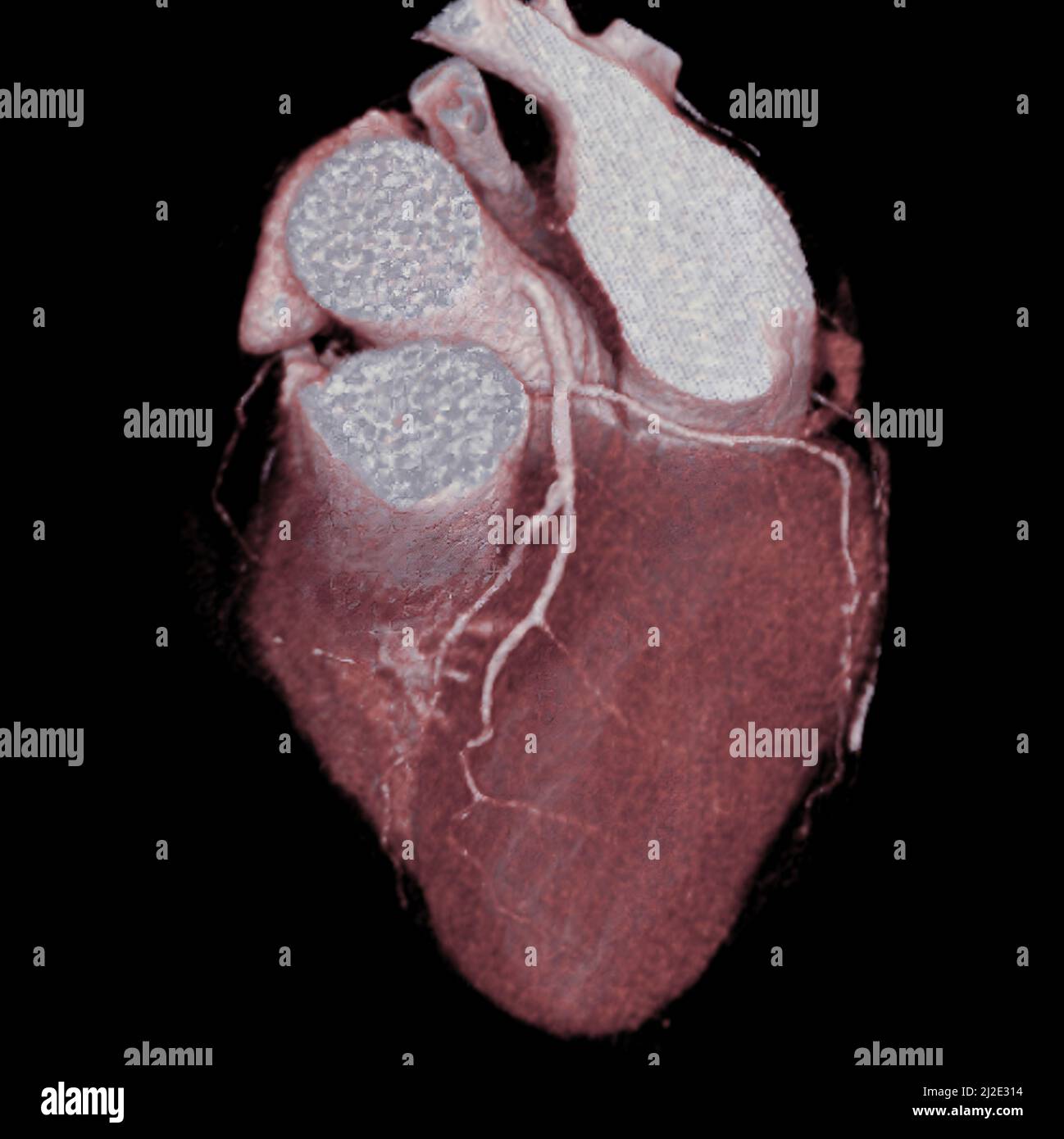 Human heart coronary arteries hi-res stock photography and images - Alamy