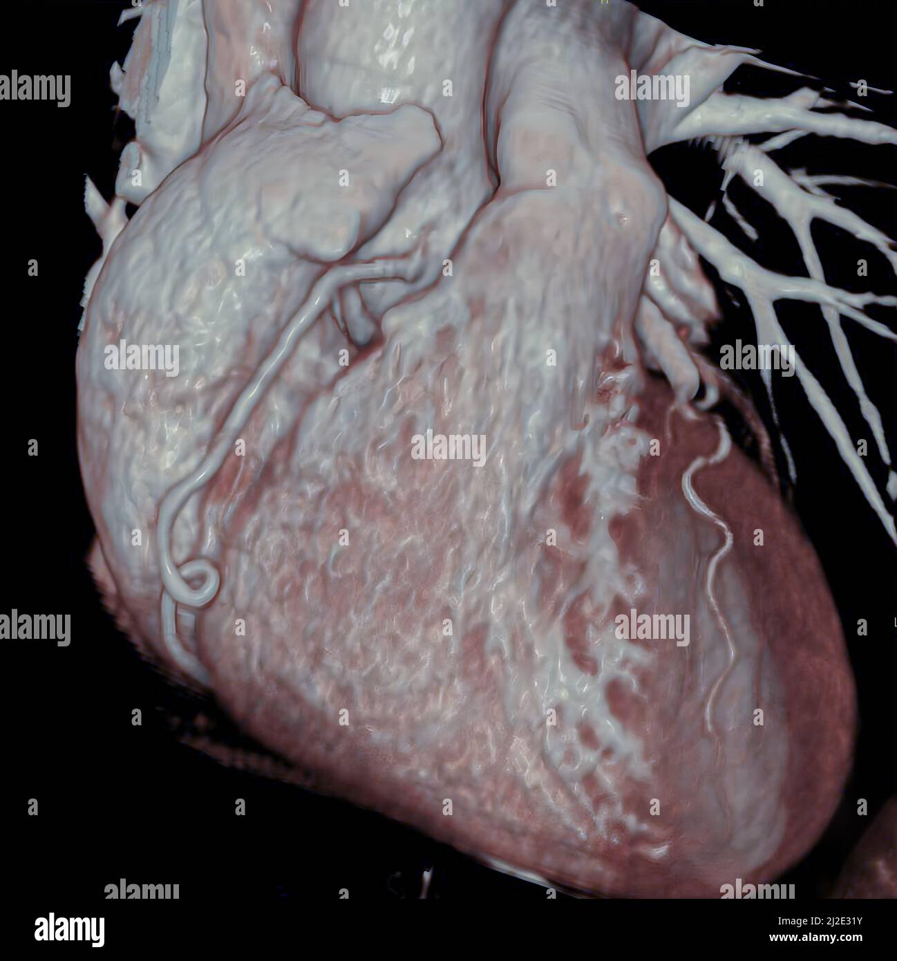 Ct scan heart hi-res stock photography and images - Alamy