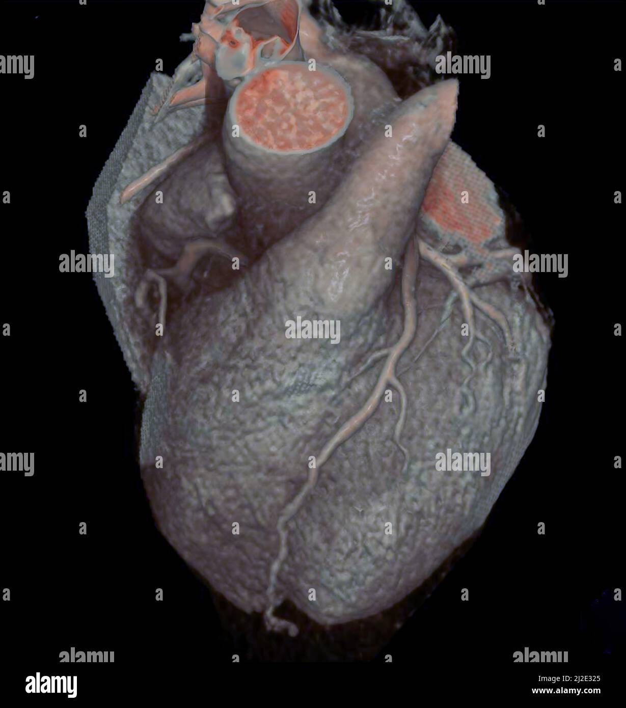 3d ct scan human heart hi-res stock photography and images - Alamy
