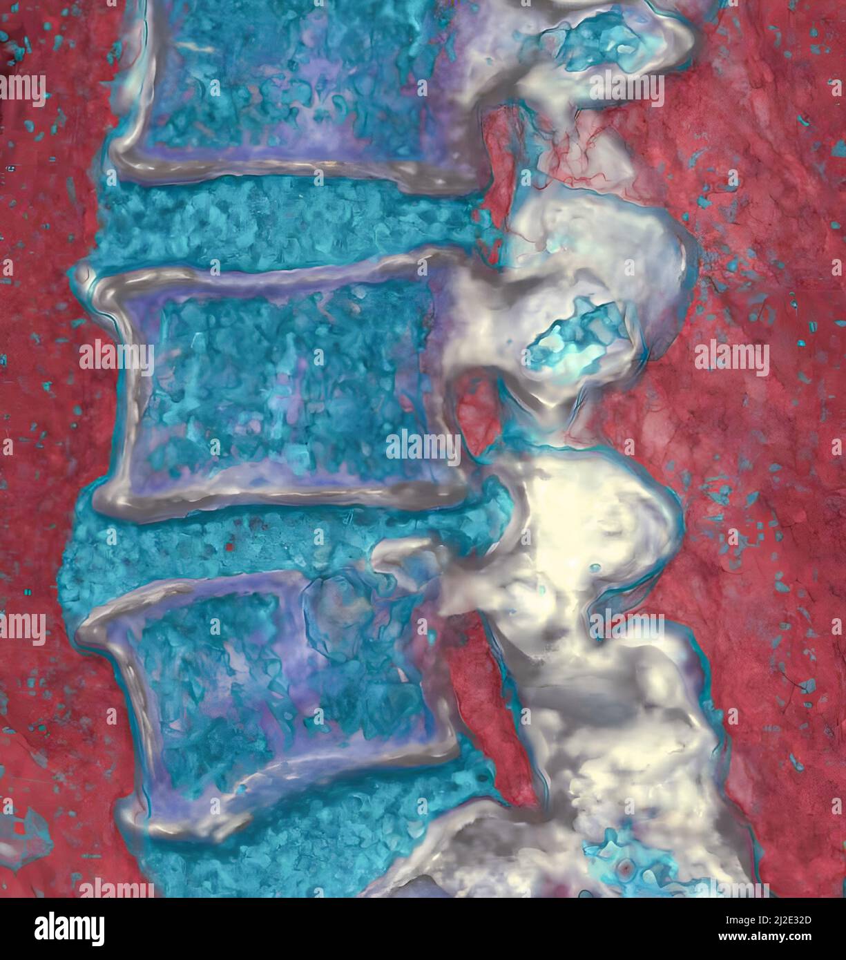 3d ct scan hi-res stock photography and images - Alamy