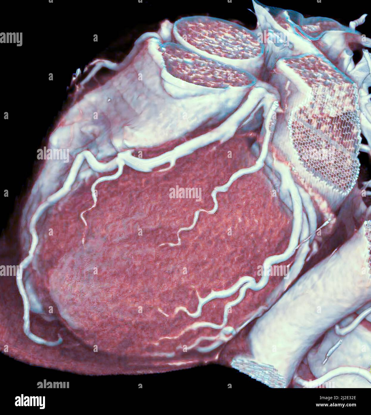 3d ct scan hi-res stock photography and images - Alamy