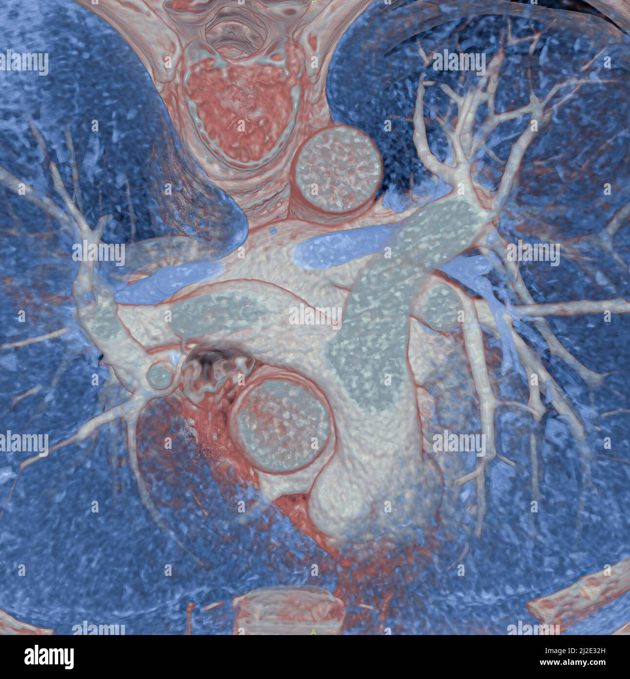 Respiratory tract, scan Stock Photo - Alamy