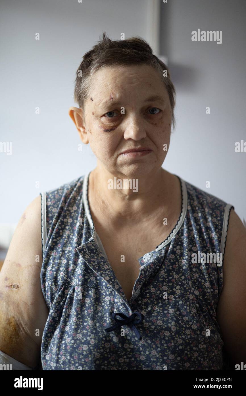 Wounded mother, Svetlana 55 yo, and her daughter, Lydia 32 yo, survived ...