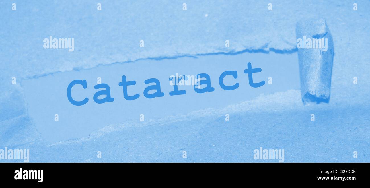 Cataract word written under brown torn paper. Eyes healthcare concept ...