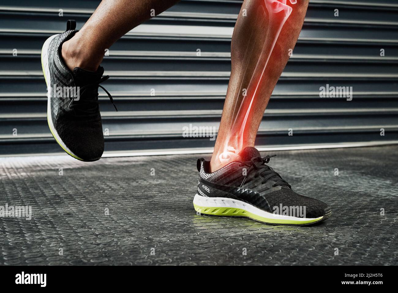 Which are the tibia and the fibula hi-res stock photography and images ...