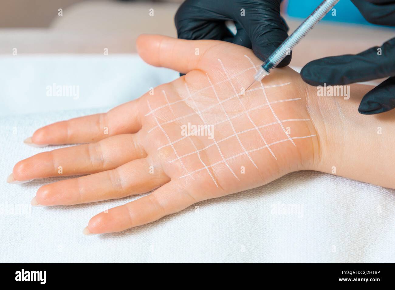 Professional cosmetology. Doctor makes injections of botulinum toxin on ...