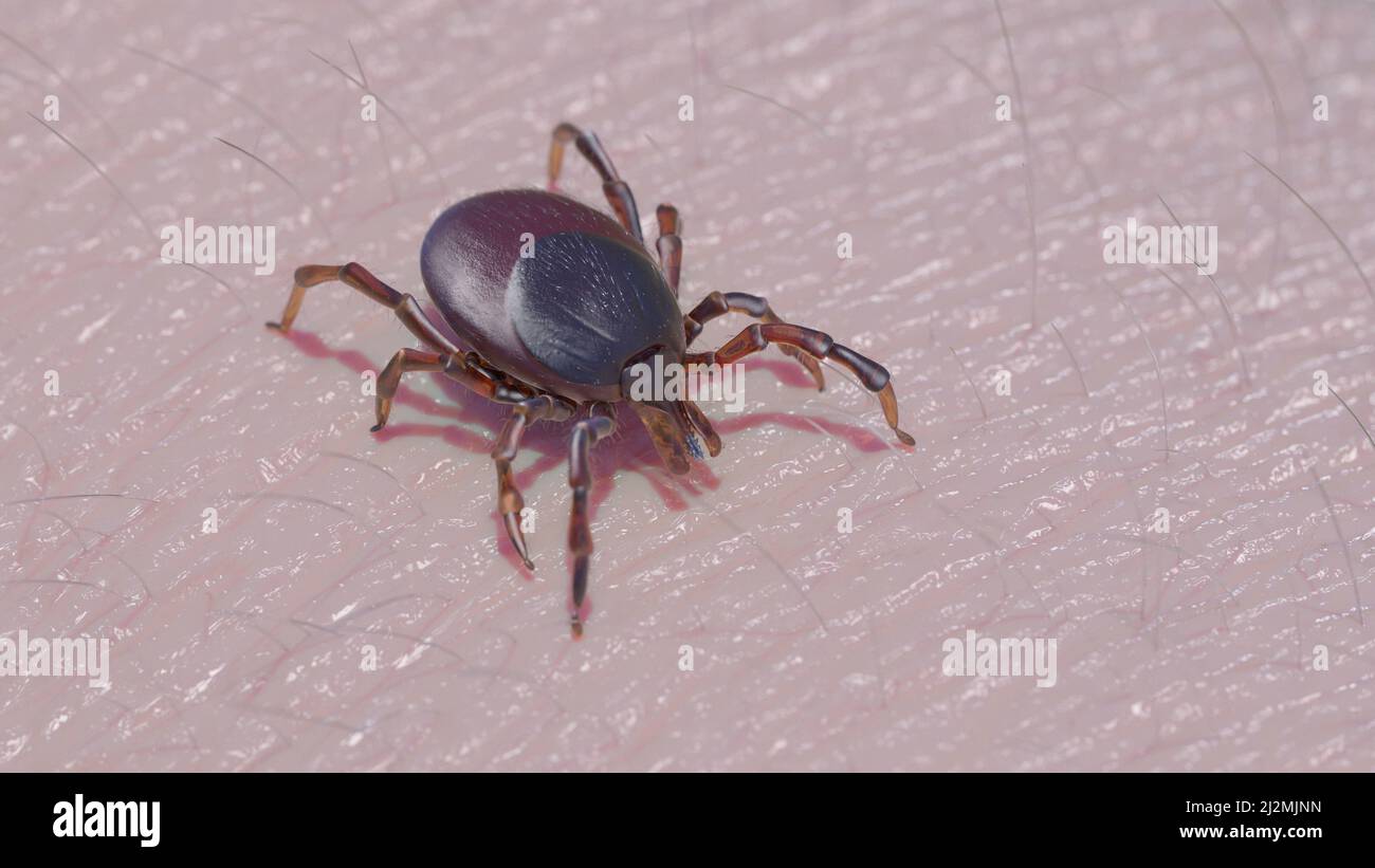 Tick on human skin, illustration Stock Photo - Alamy