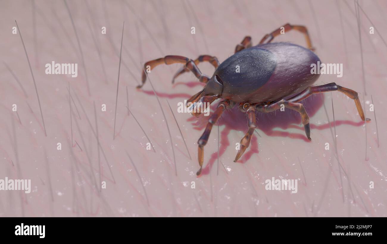 Tick on human skin, illustration Stock Photo - Alamy