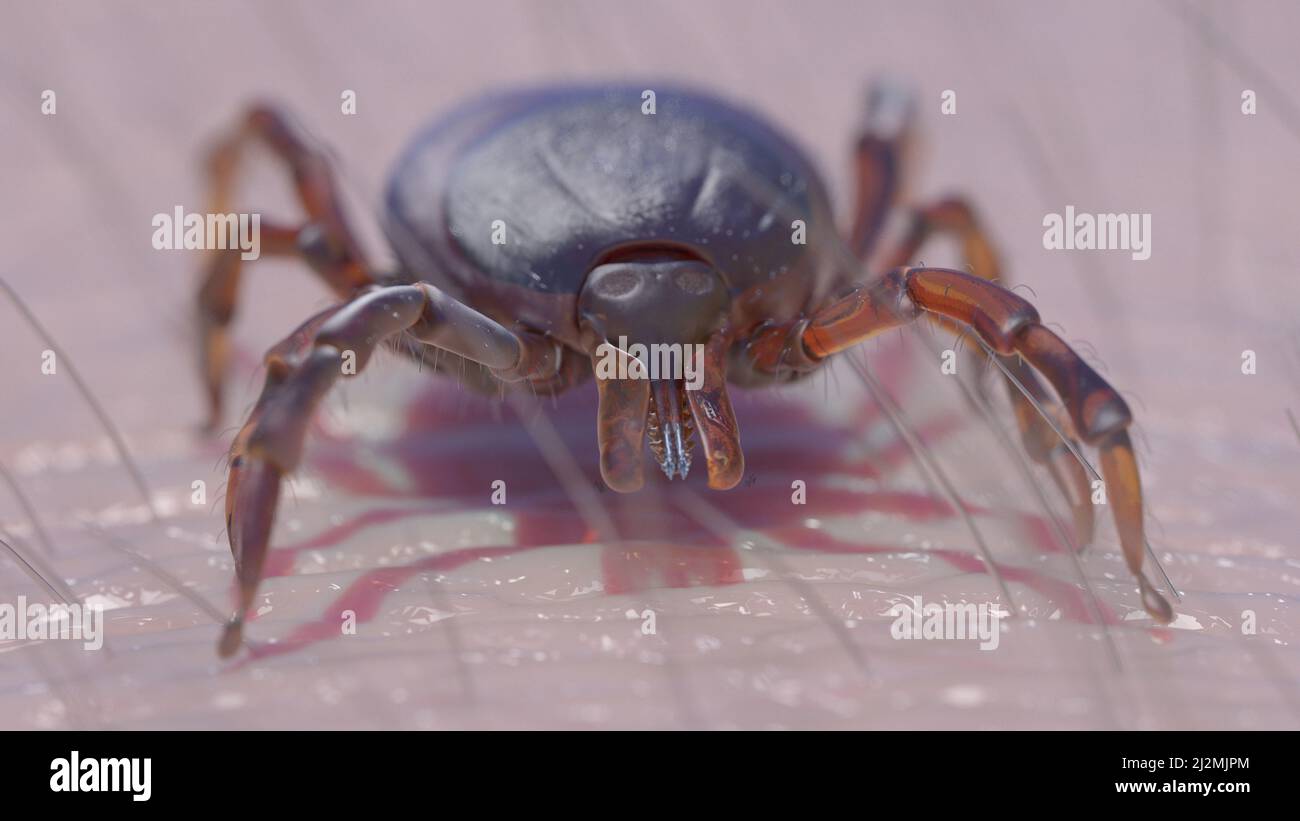 Tick on human skin, illustration Stock Photo - Alamy