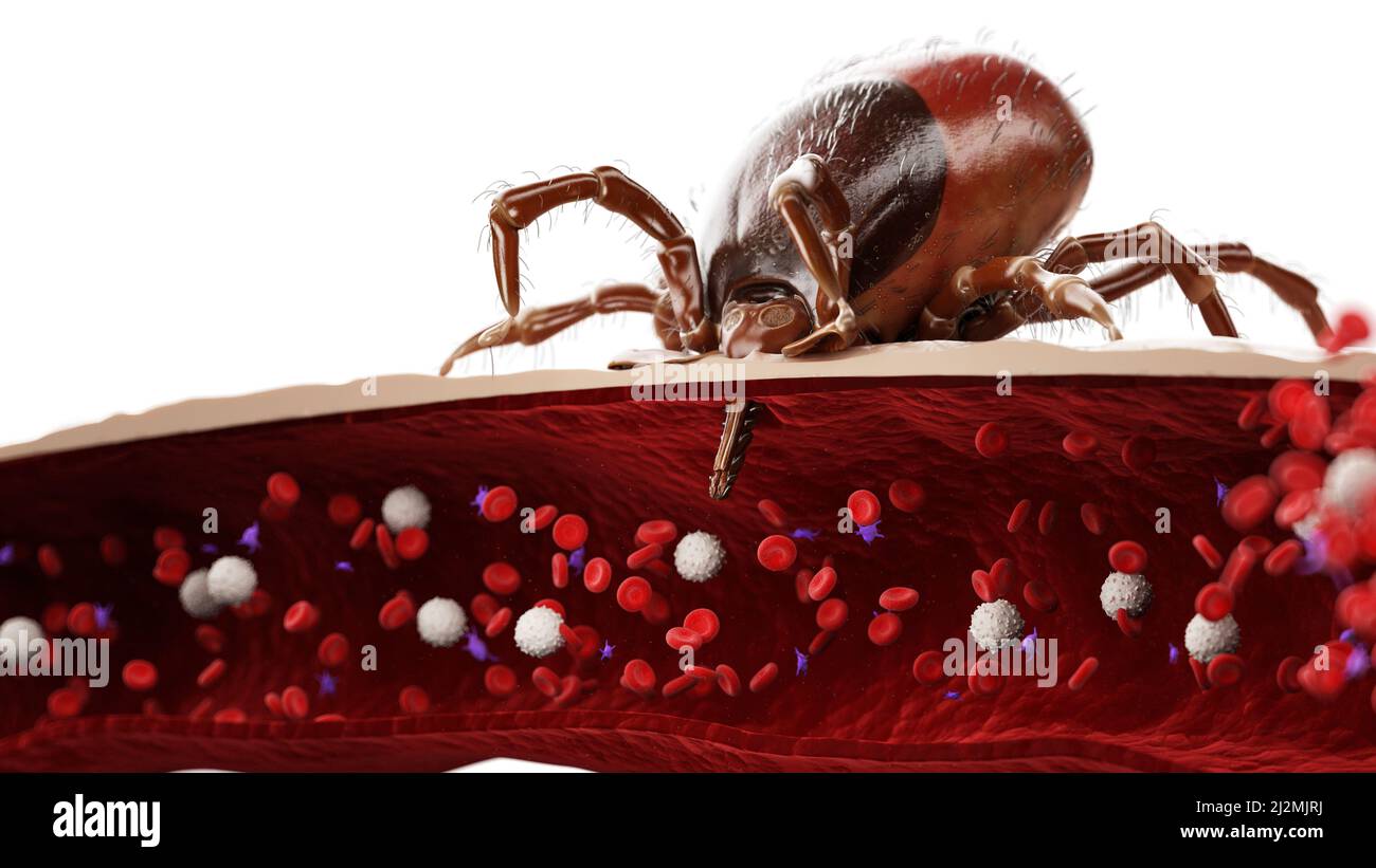 Tick feeding on blood, illustration Stock Photo - Alamy