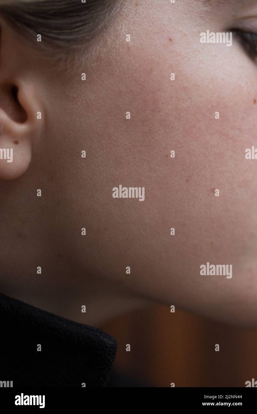 Young woman cheek - beautiful white healthy skin Stock Photo - Alamy