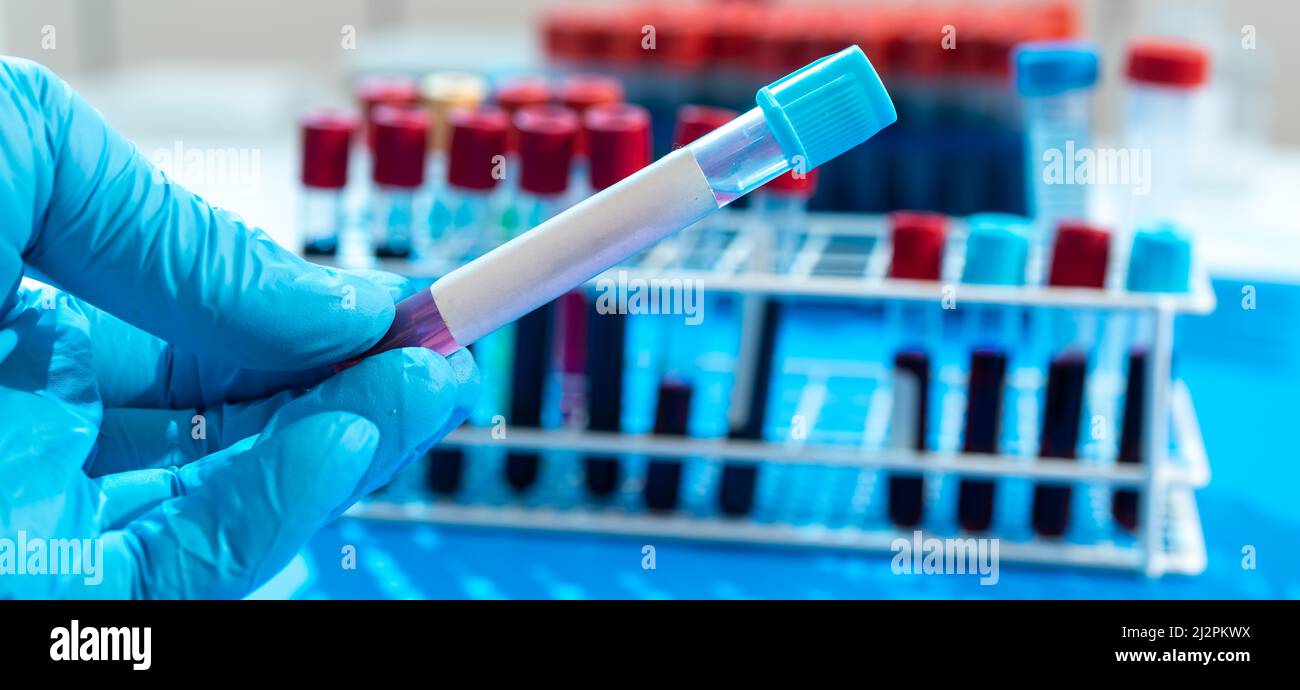 Test tube with empty label to laboratory research Stock Photo - Alamy