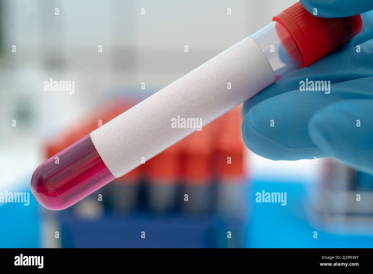 Test tube with empty label to biological sample for medical laboratory ...