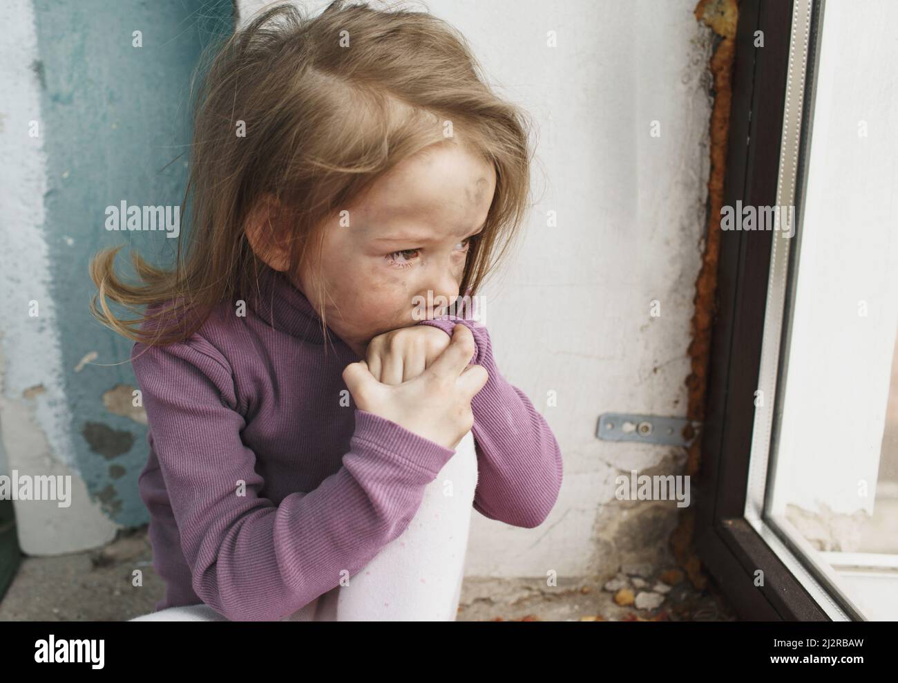 a little Ukrainian girl with a face blackened by fire, crying sitting ...