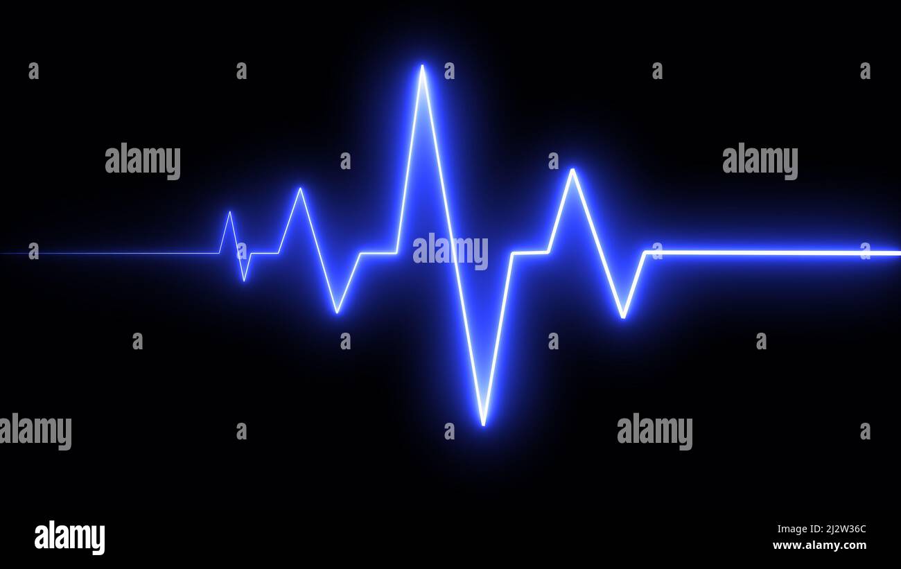 Ekg electrocardiogram blue hi-res stock photography and images - Alamy