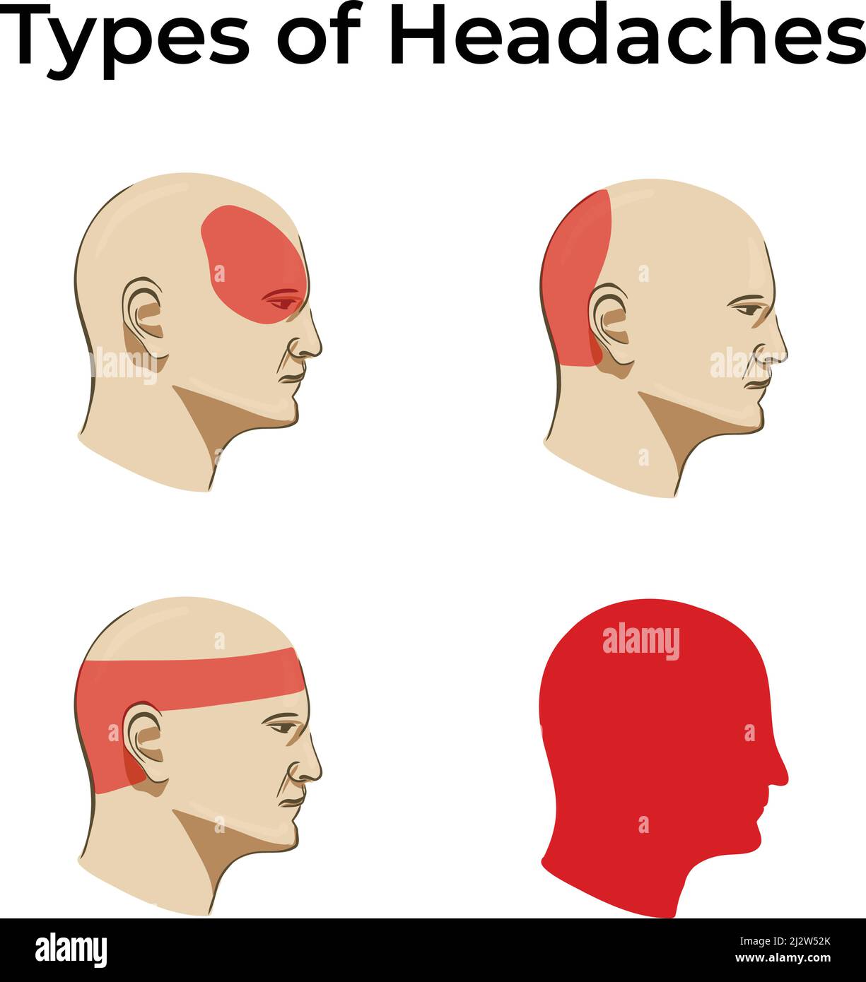 Meme Template Cut Out Stock Images & Pictures - Alamy