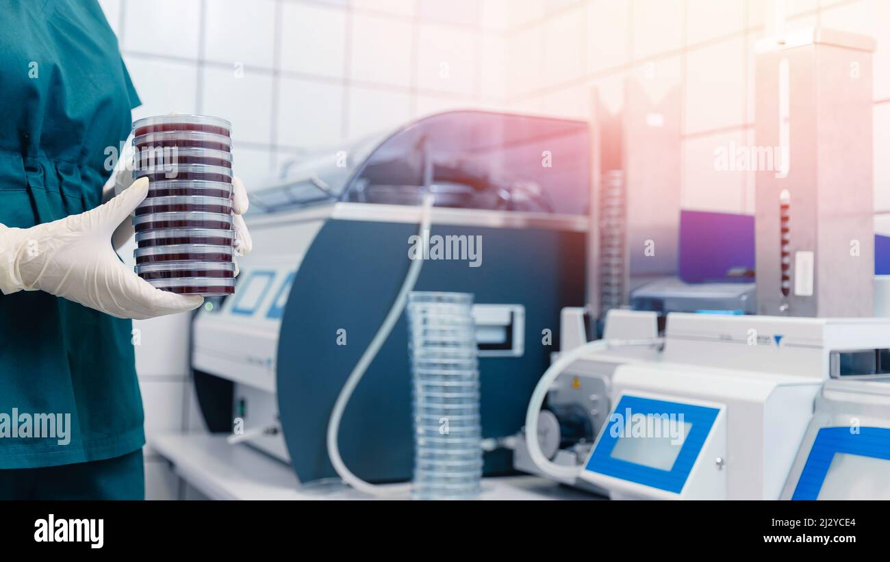Nurse holds samples to analyze scraping of bacteria in blood, sowing ...